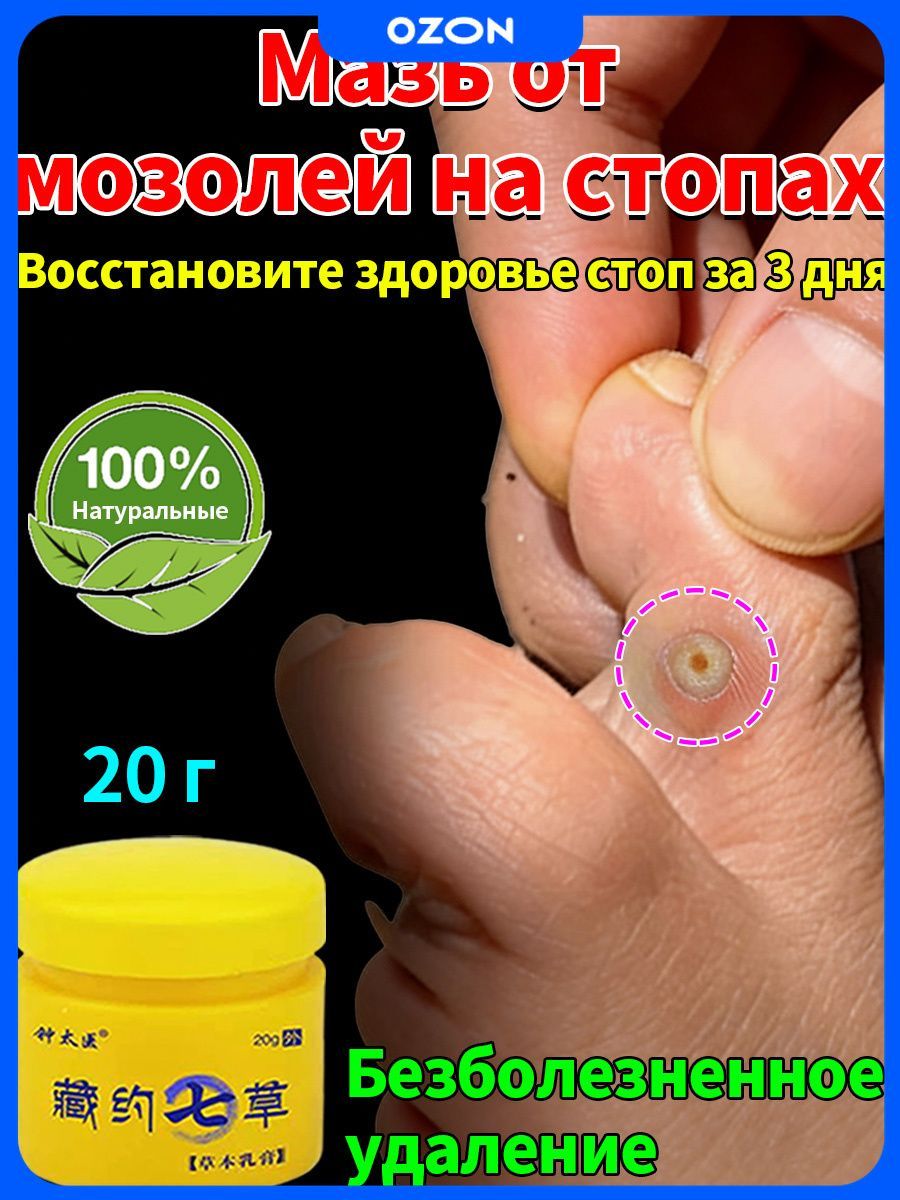 Пластырь от мозолей, стержневых натоптышей и бородавок 20 г Китайский чудо мазь
