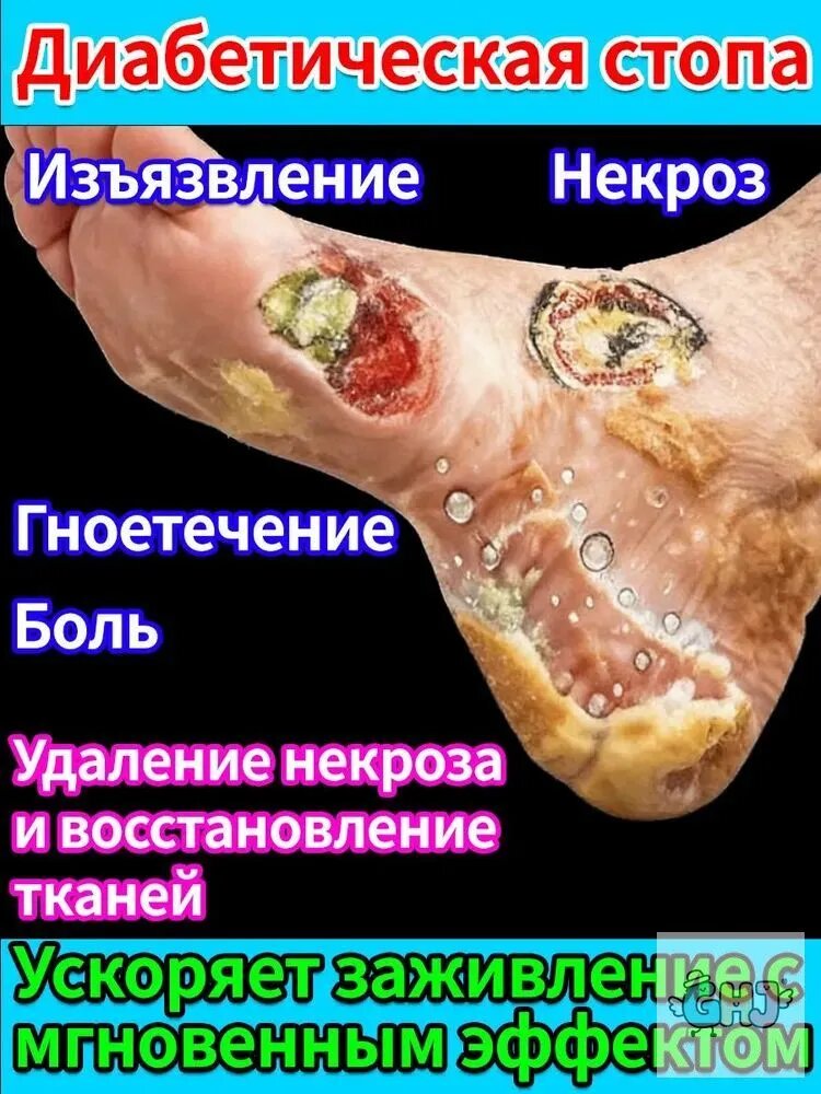 Регенерирующая мазь от пролежней и некроза: лечение ран и восстановление кожи