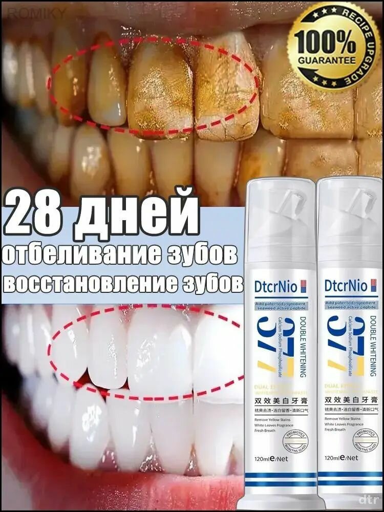 Мощная отбеливающая зубная паста, против зубного камня и налета от кофе и сигарет, против неприятного запаха изо рта, отбеливающая, для чувствительных зубов 120 г-0329