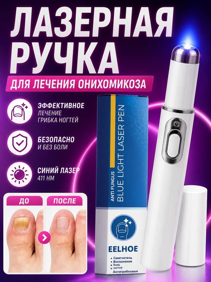 Безопасное удаление грибка, безболезненная терапия, устройство для домашнего использования, Лазерная ручка для лечения онихомикоза портативный медицинский лазер для ногтей