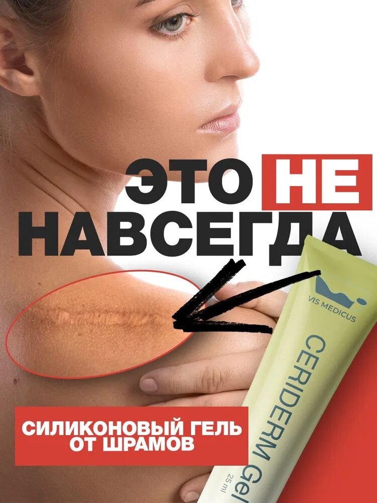 Гель от шрамов и рубцов Ceriderm / Крем от шрамов, от постакне, от прыщей, крем от растяжек, от ожогов / 25 мл
