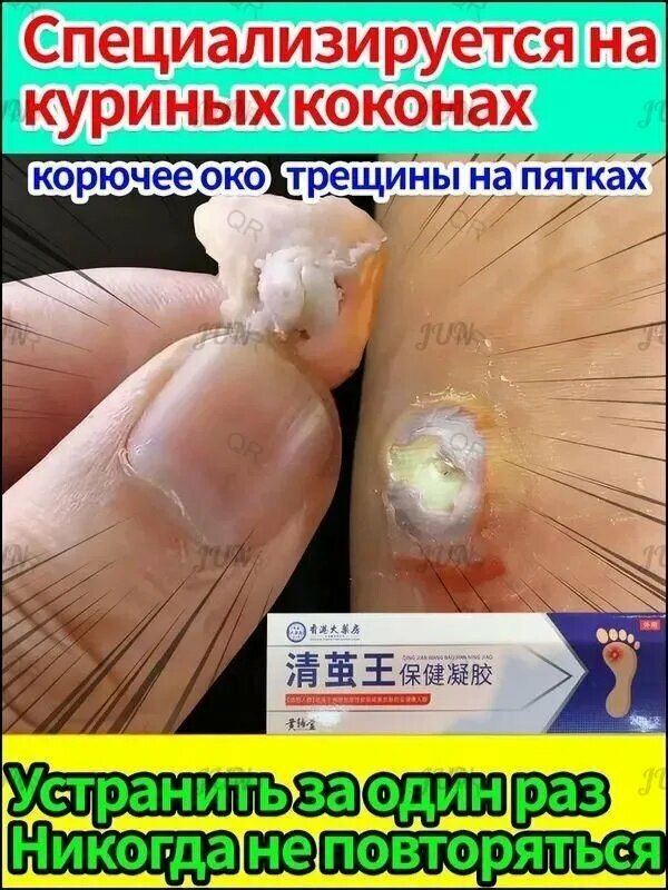 Средство для удаления натоптышей на ногах. Быстрый эффект/20 г