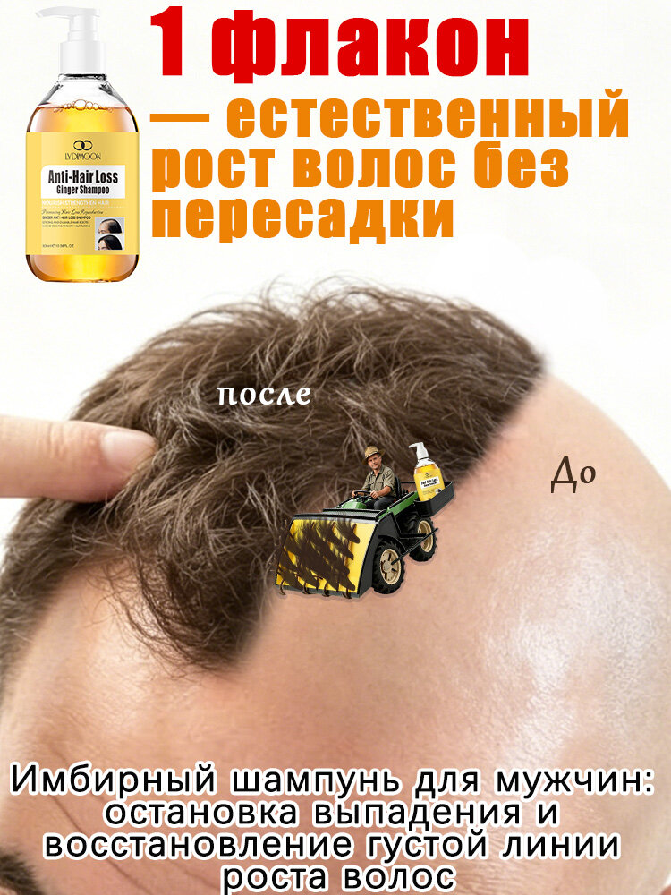 Шампунь против выпадения волос LYDIMOON