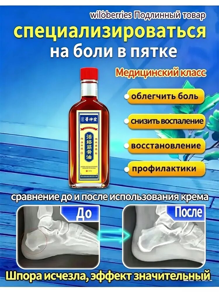 Медицинская желчь для пяточной шпоры жидкая 51 г
