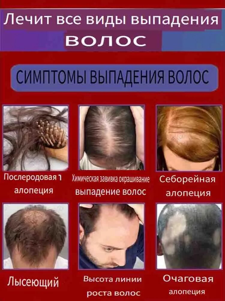 Сыворотка для волос, 30 мл — фото 1
