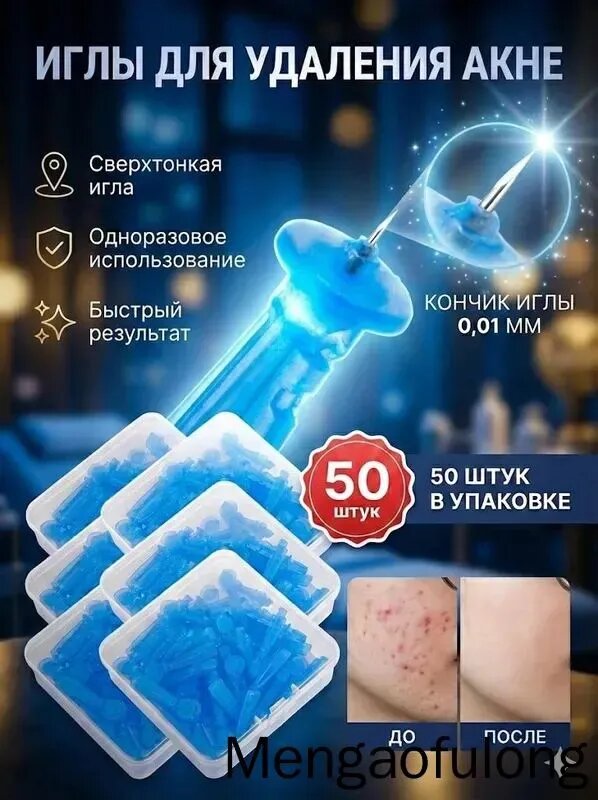 Иглы для удаления прыщей, 50 шт.