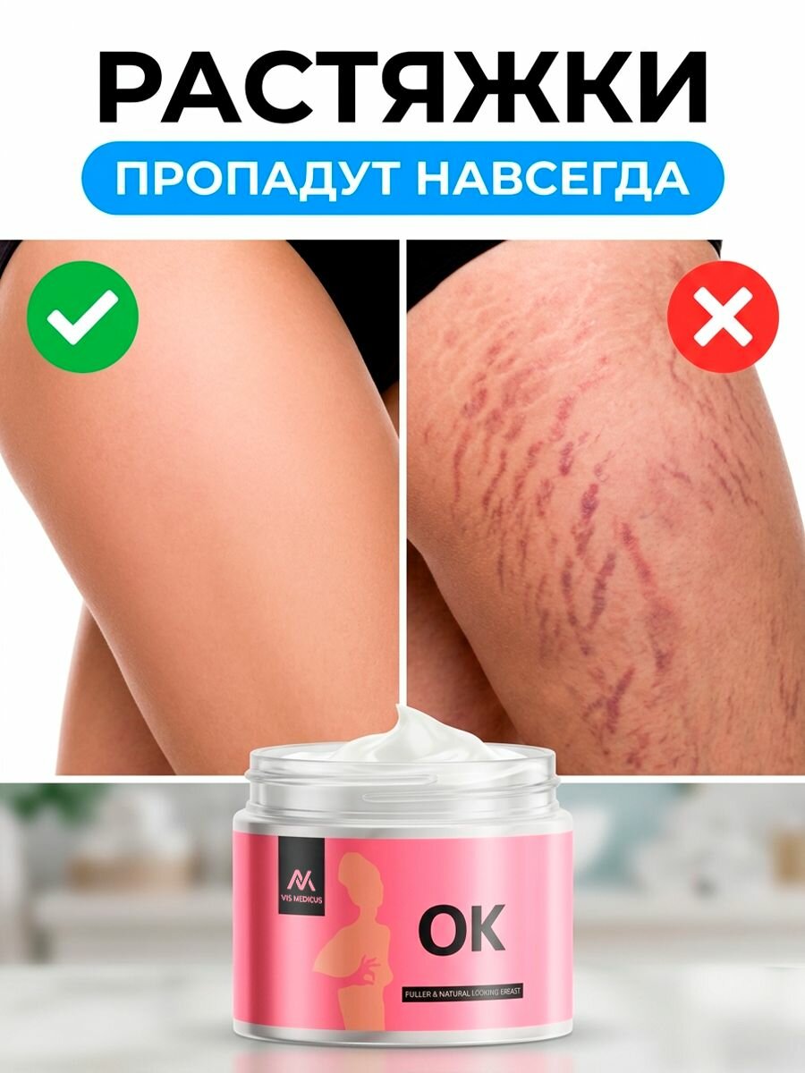 Крем от растяжек OK / Крем от растяжек для беременных, от целлюлита / 225 мл