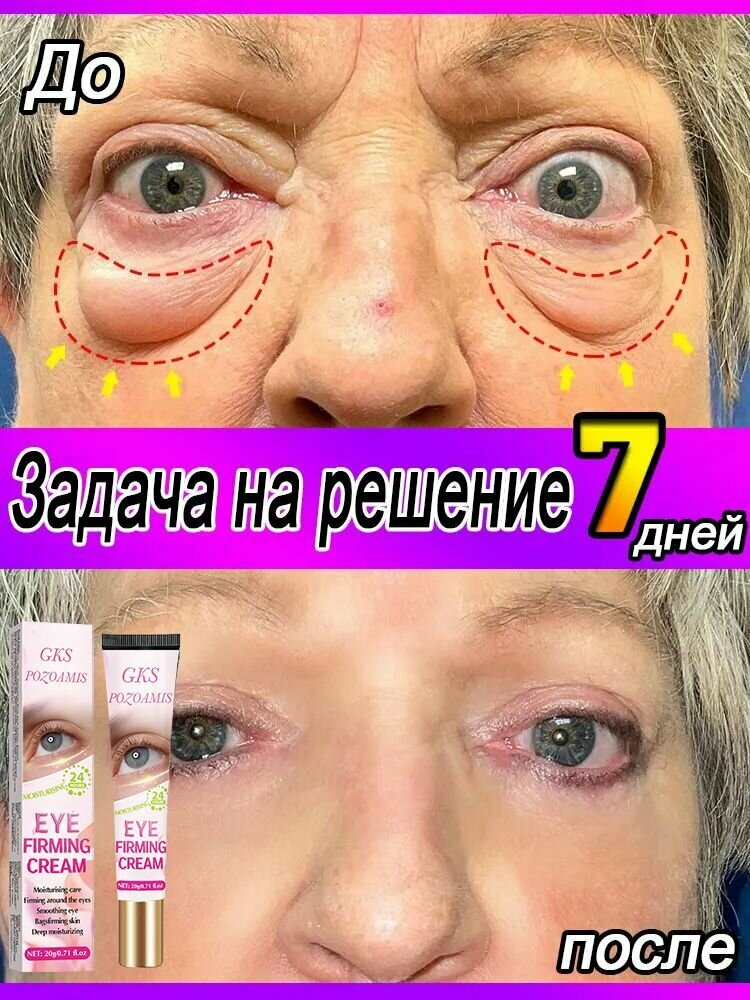 Крем для век от морщин. Устраните темные круги, мешки под глазами, отечность, выделение меланина, морщины и восстановите молодость и жизненную силу.20 мл от темных кругов от мешков под глазами от отечности против морщин