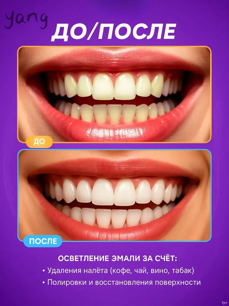 Yoshida Зубная паста FRESH Dazzling Foam Toothpaste, 220 мл, с комплексом Mineralin Enzyme, отбеливающая — фото 1