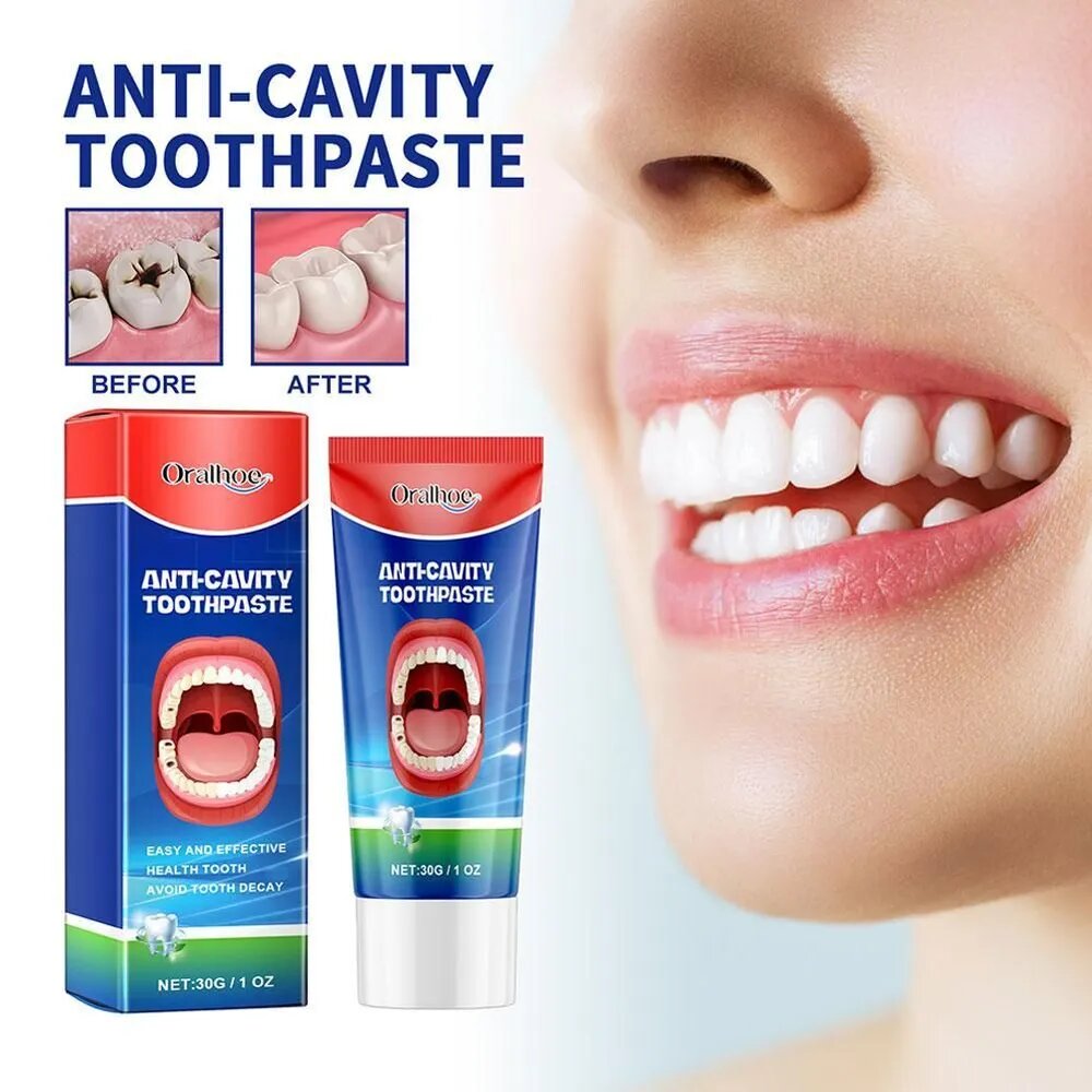 Зубная паста ORALHOE против кариеса и отбеливающая, для удаления желтизны и защиты десен, уход за эмалью 30 г