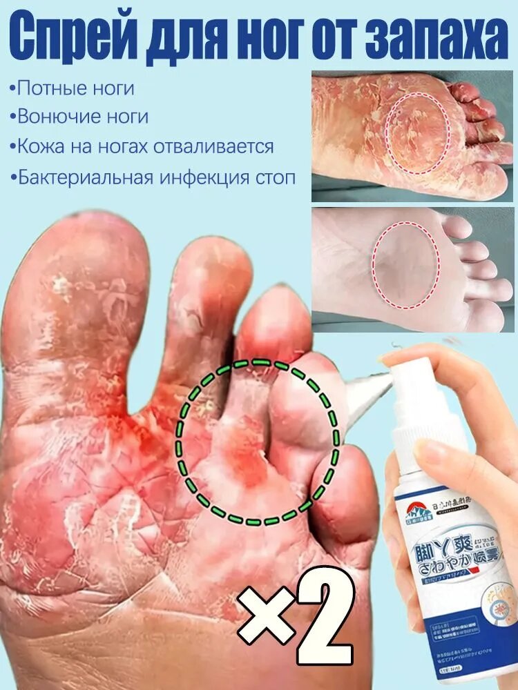 Спрей для ног от запаха и пота, спрей с антибактериальным действием для уменьшения потоотделения ног, устранения неприятного запаха, профилактика грибка, мужской и женский 60мл