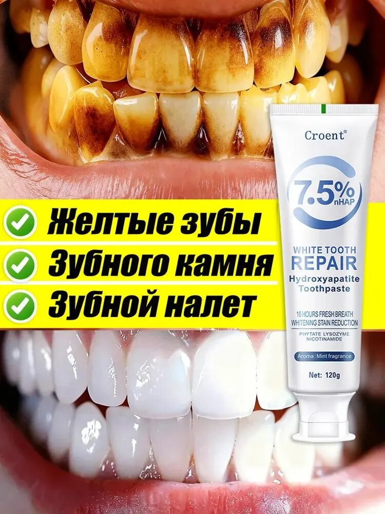 Мощная отбеливающая зубная паста 120 г, удаление зубного камня, отбеливание желтых зубов, освежение дыхания, защита десен
