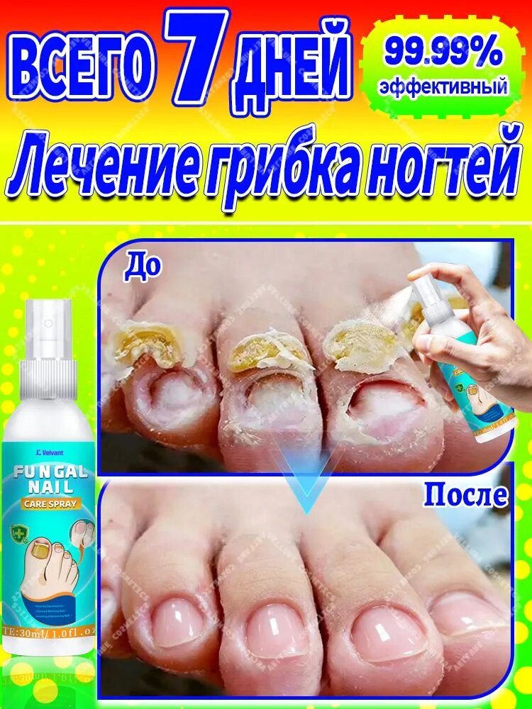 Спрей для лечения грибка ногтей на руках и ногах, для восстановления при плесневых инфекциях, укрепления ногтей, удаления ороговевшего слоя и устранения онихомикоза.300 мл