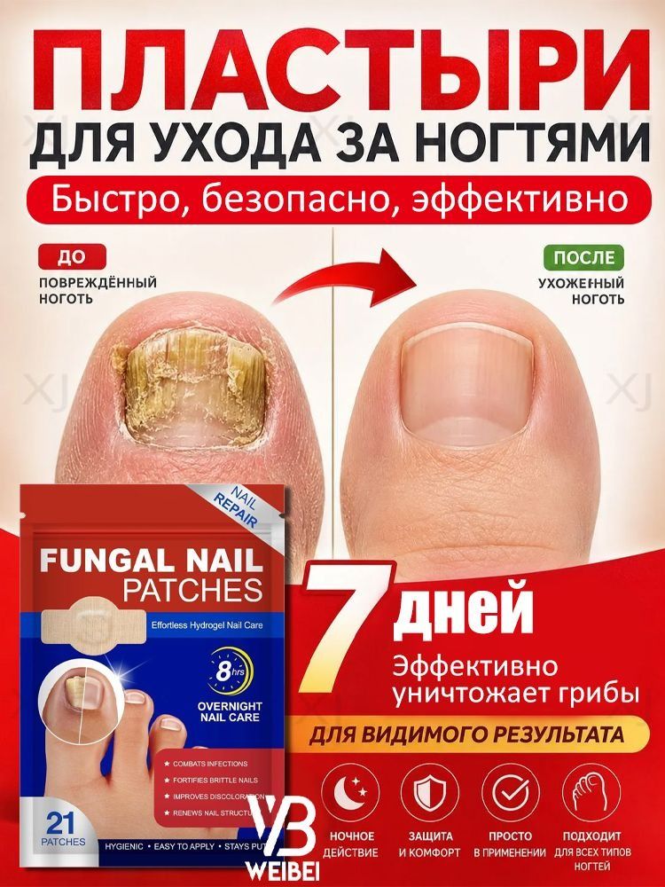 Пластыри от грибка ногтей быстро избавляют от грибковых инфекций рук и ног, а также вылечить утолщение ногтей, покраснение, отек, зуд, расслоение 21шт