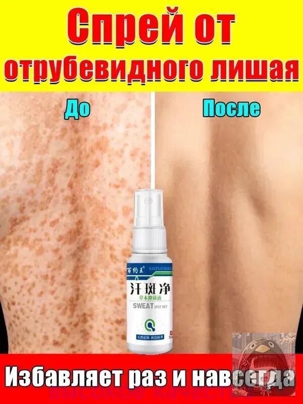 Спрей от разноцветного лишая (отрубевидного), лечение кожных грибковых инфекций