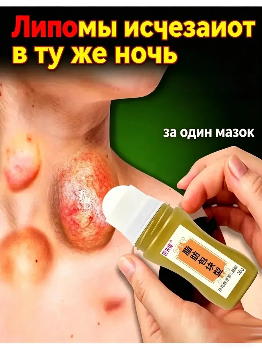 Средство для удаления жировиков