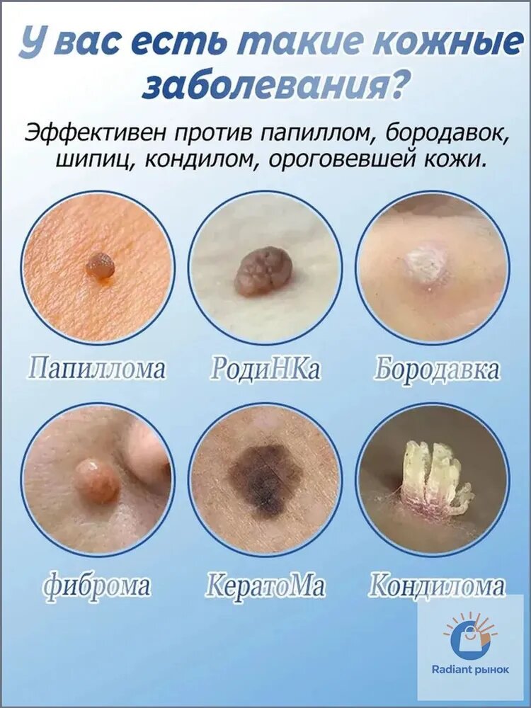 Твердое мыло — фото 1
