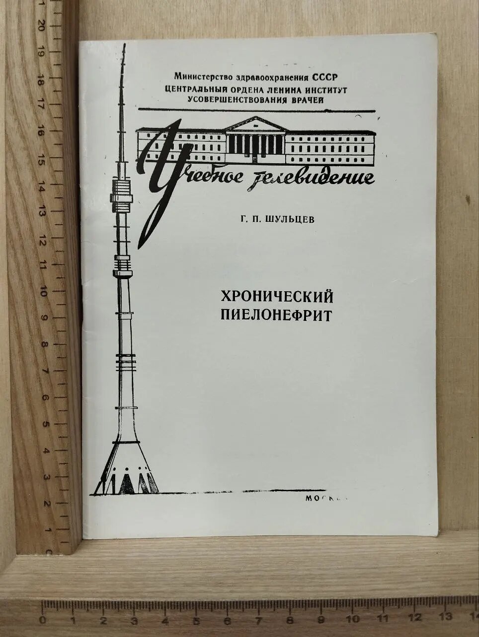 Хронический пиелонефрит