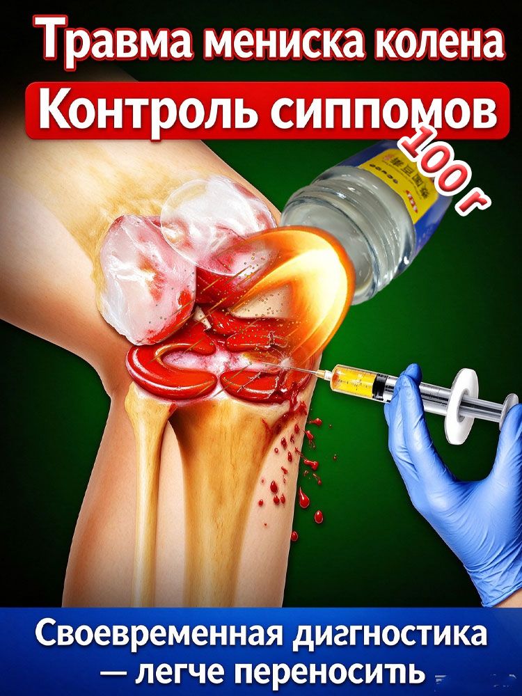Чудо мазь с обезболивающим эффектом ЯД скорпиона для суставов ног и рук от ушибов и растяжений, артрита, болей в мышцах