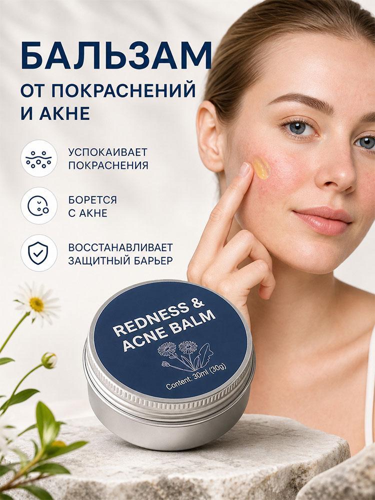 Крем для лица от покраснений и акне, 30 мл