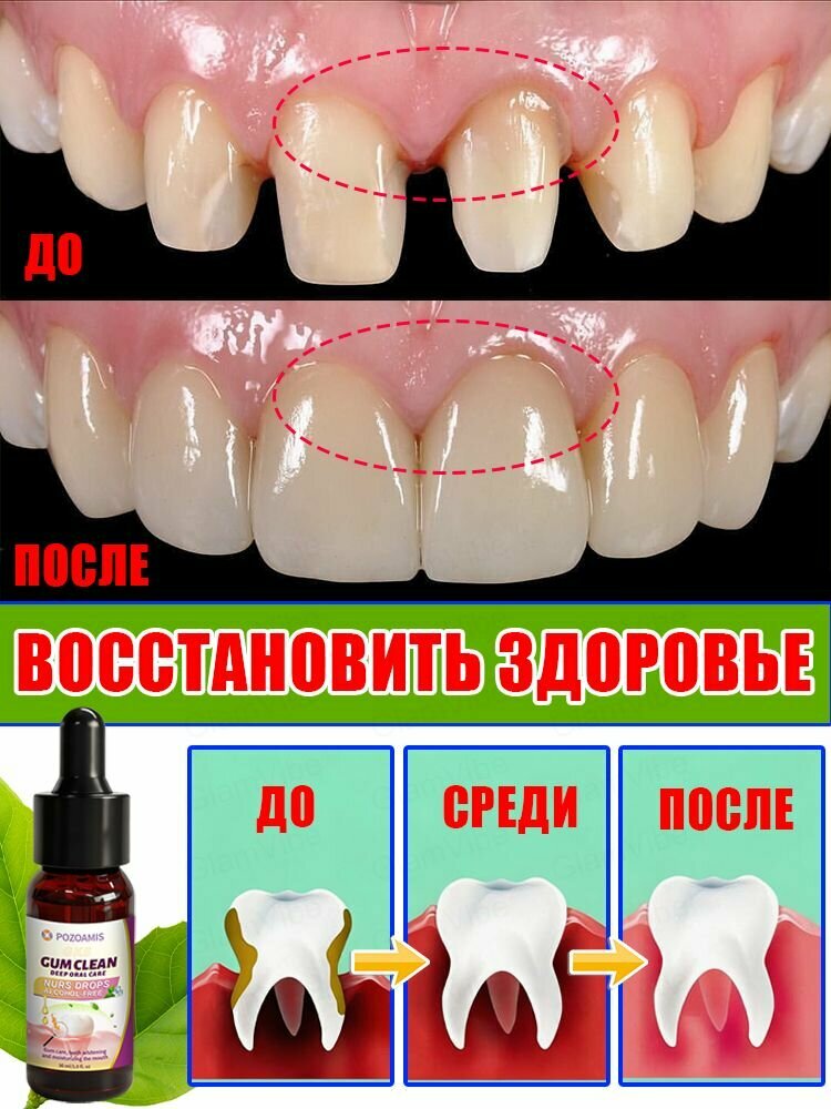 Используется для лечения пародонтита, стоматита, снятия чувствительности и отека десен, восстановления, профилактики и укрепления поврежденных десен, Гигиена полости рта.90 мл.