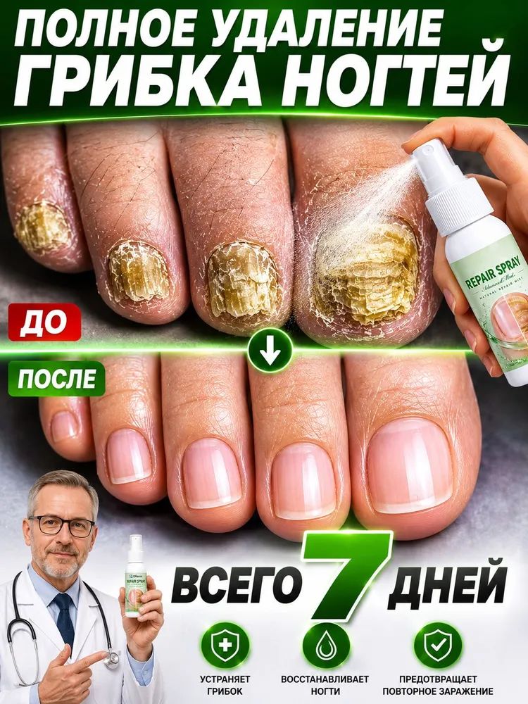 Спрей от грибка ногтей, для лечения грибка и онихолизиса, восстановления и роста / 30 мл