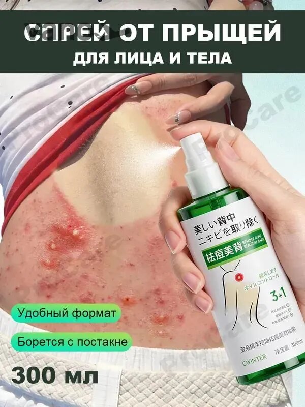 Спрей от прыщей для лица и тела, средство для проблемной кожи, 300 мл