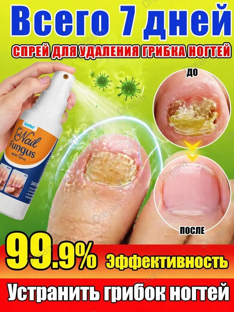 Спрей от грибка ногтей противогрибковый, 30 мл, для лечения грибка и онихолизиса, восстановление и уход