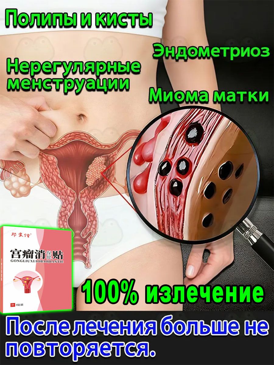 Пластыри традиционной китайской медицины для лечения аденом, миомы матки, эндометриоза, кист и полипов.