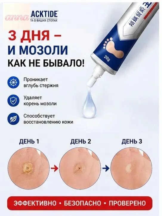 Средство от шипиц, натоптышей и сухих стержневых мозолей на ногах мазь и гель Корнекс, эффективное китайское средство