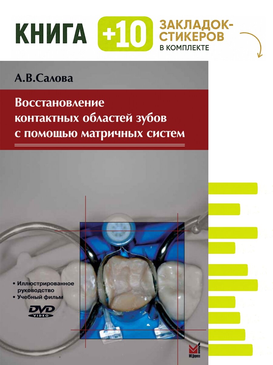 Восстановление контактных областей зубов с помощью матричных систем 2-е изд. Комплект: книга + 10 закладок-стикеров