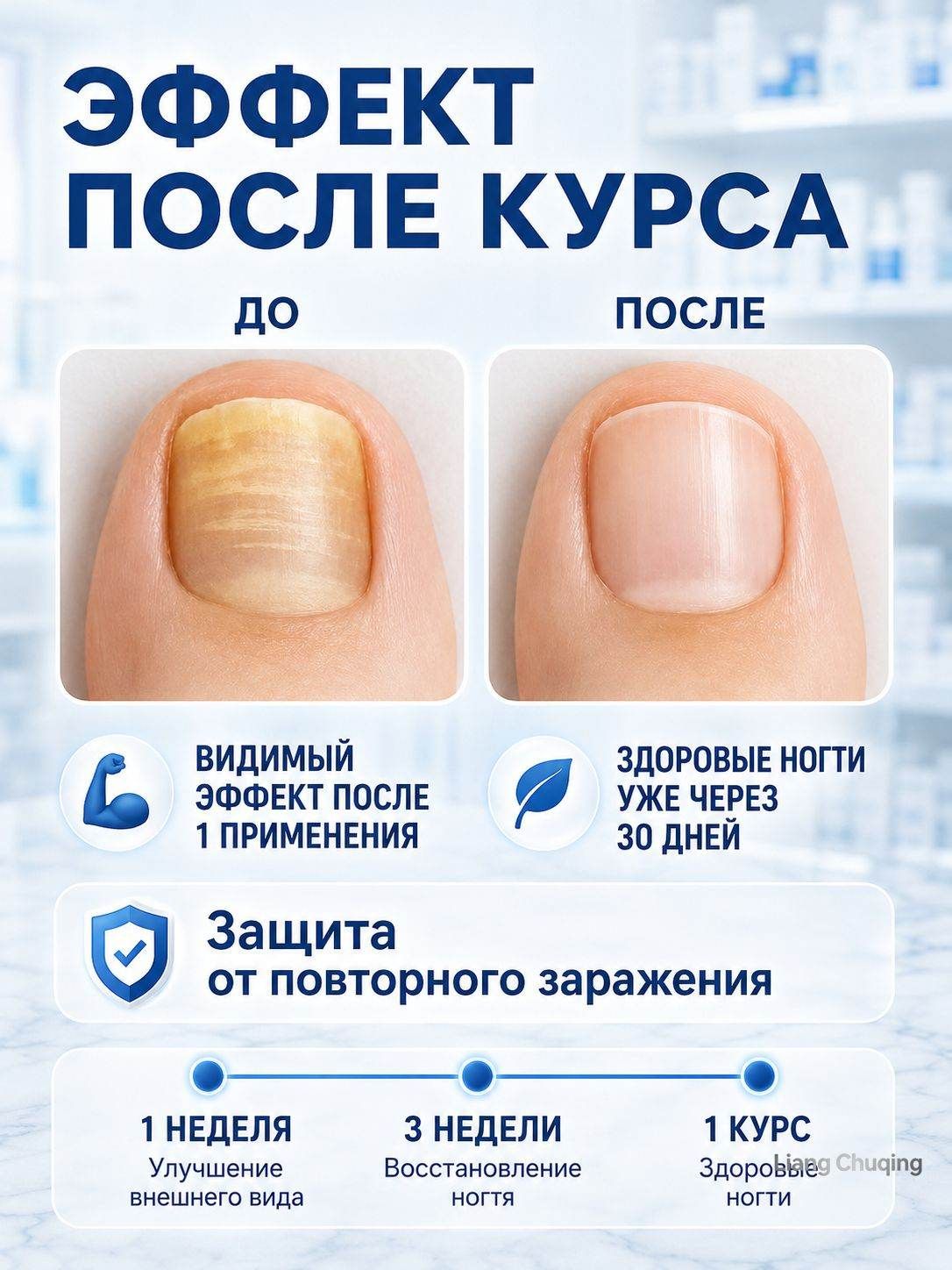 Противогрибковый крем для ногтей и стоп Эффективное средство от грибка ногтей на ногах Быстрое действие, глубокое проникновение