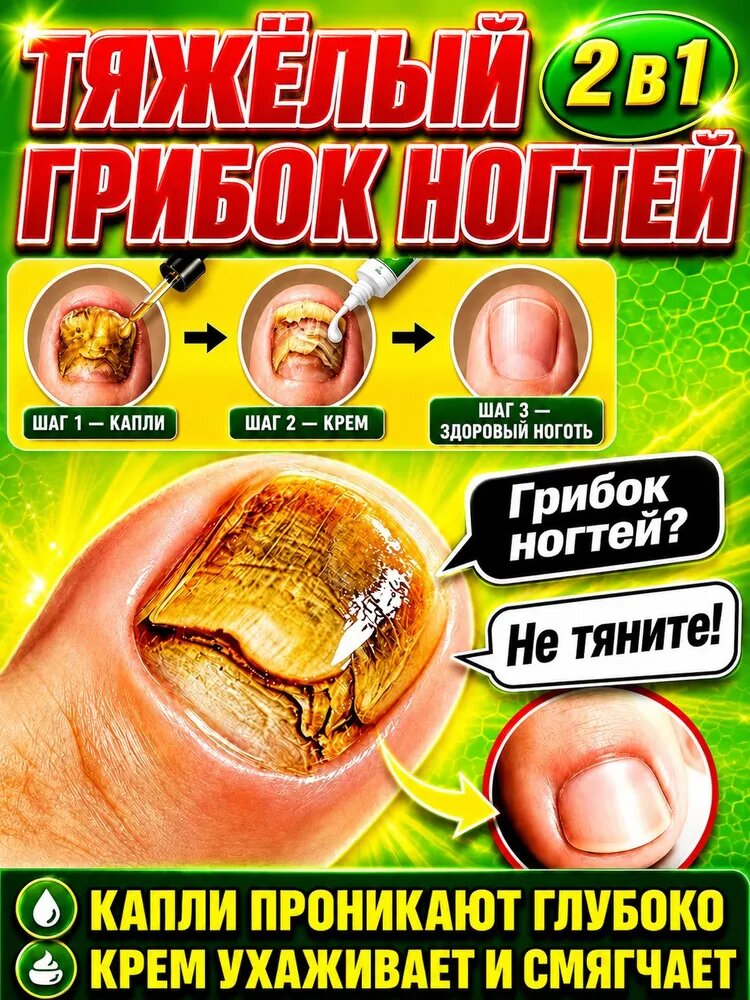 Монастырская мазь для проблемных ногтей, уход за желтыми, ломкими и утолщенными ногтями, капли и крем