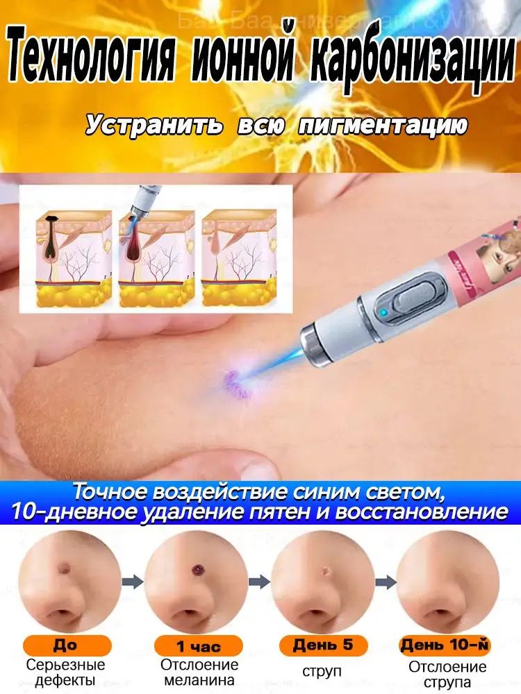 Удаляет пигментные пятна, веснушки, солнечные ожоги, меланодермию, угревую сыпь, морщины. Лазерная указка устраняет