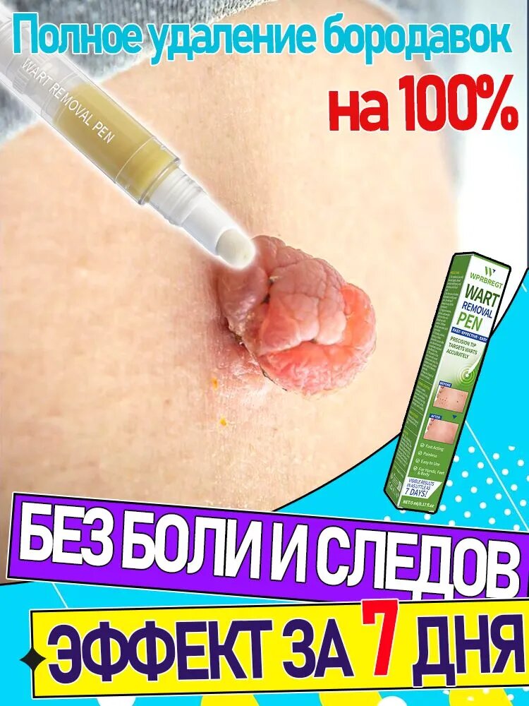 Ручка для удаления бородавок и папиллом аккуратно помогает избавиться от бородавок, сухих мозолей и наростов за 7 дней. Можно использовать на телеруках и шее. С чистотелом, без боли и следов. 1 шт.