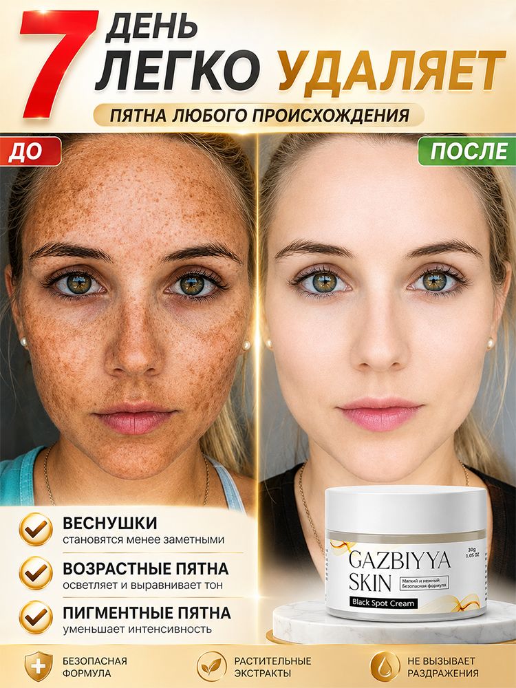 Отбеливающий крем для лица, эффективно удаляет возрастные пятна, веснушки, черные пятна и желтые пятна, выравнивает тон кожи, защищает от солнца, придавая коже сияние / 30 г