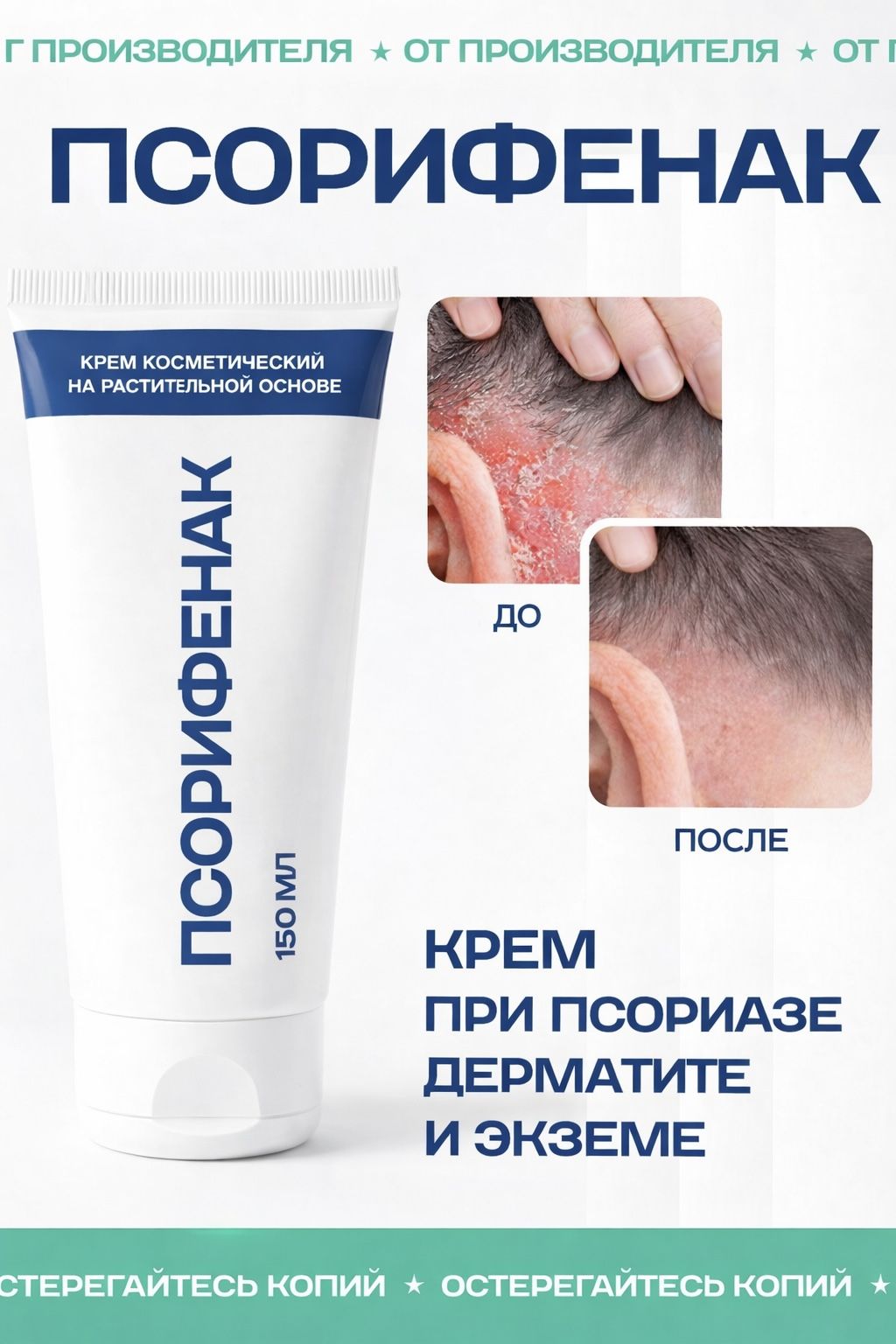 Псорифенак, Крем для лица от дерматита, для тела, от экземы, мазь от псориаза, от прыщей на лице и акне, атопический дерматит, увлажняющий рег