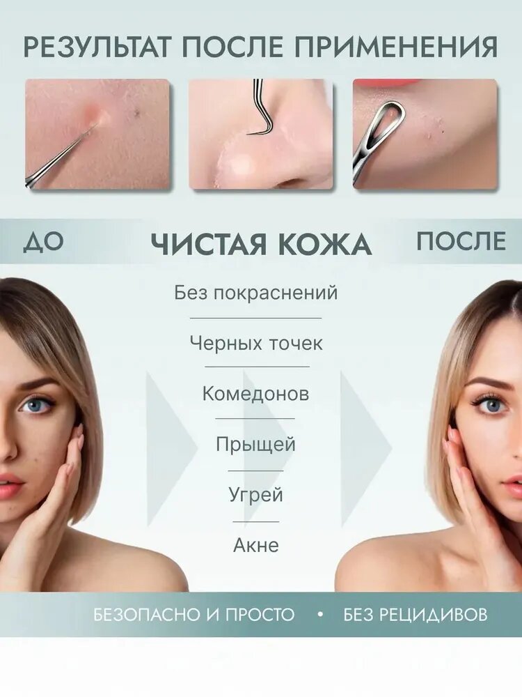 Набор для чистки лица выдавливания прыщей палочка давилка