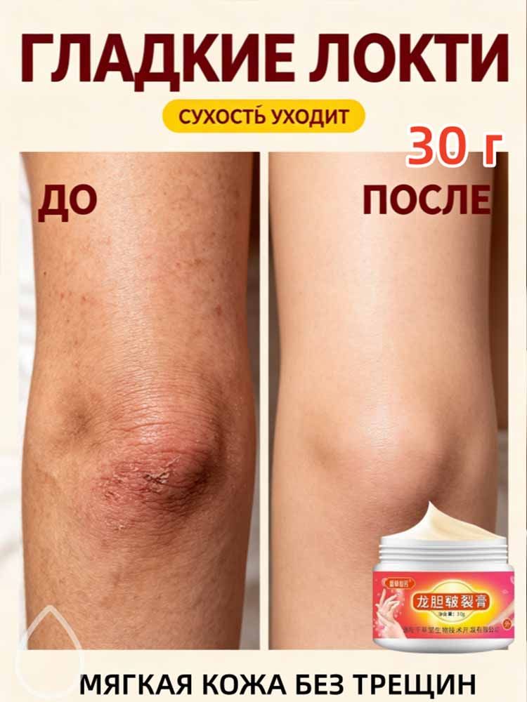Бальзам для ухода за растрескавшейся кожей рук, пяток, локтей, растительный состав
