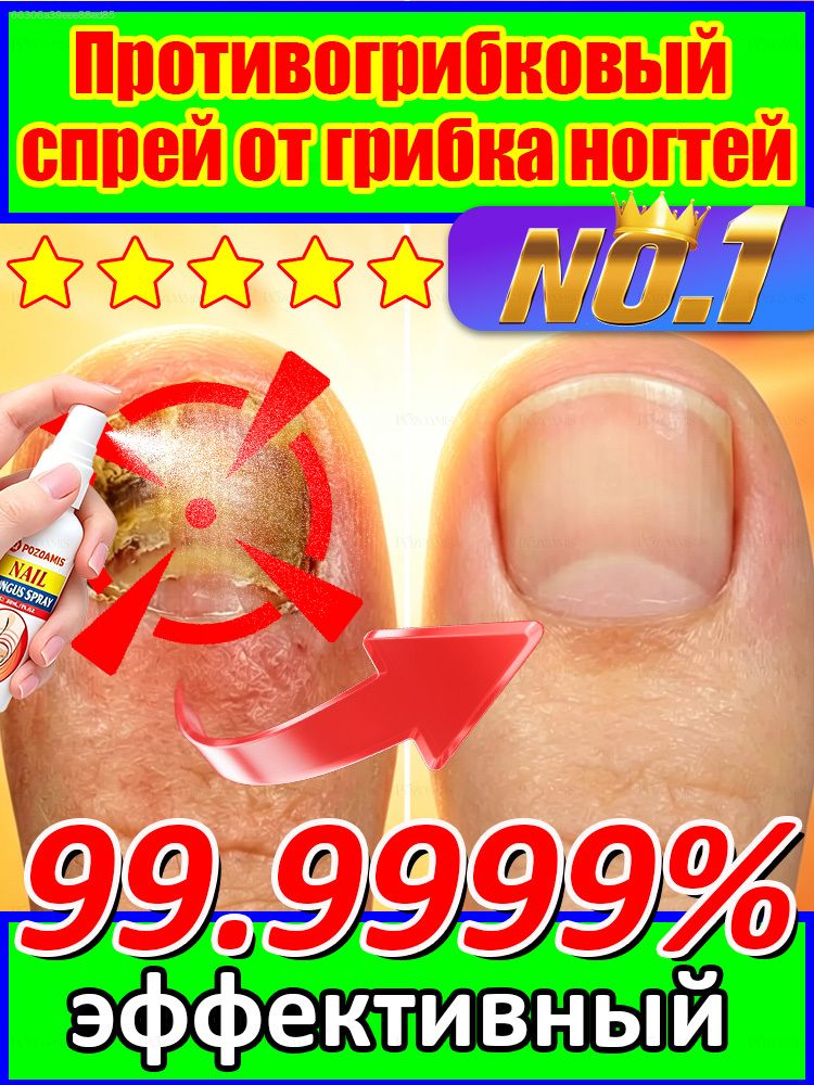 Используется для лечения грибка ногтей на ногах. Удаление грибковых инфекций, противогрибковые средства, Онихолизис , Ремонт ногтей.30 мл