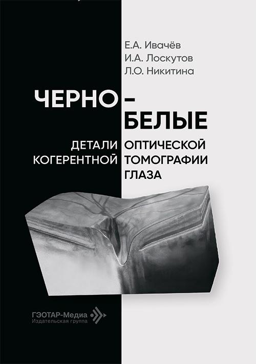 Черно-белые детали оптической когерентной томографии глаза / Е. А. Ивачёв, И. А. Лоскутов, Л. О. Ник