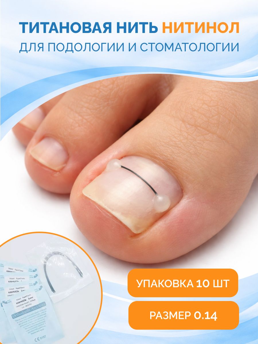 Титановая нить Nitinol суперэластичная, дуга нитиноловая для коррекции ногтя в педикюре и подологии, размер 14, упаковка 10 шт