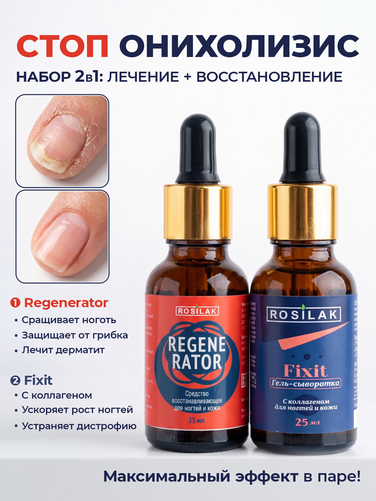 Rosilak, профессиональный набор для лечения и восстановления ногтей "Стоп онихолизис"