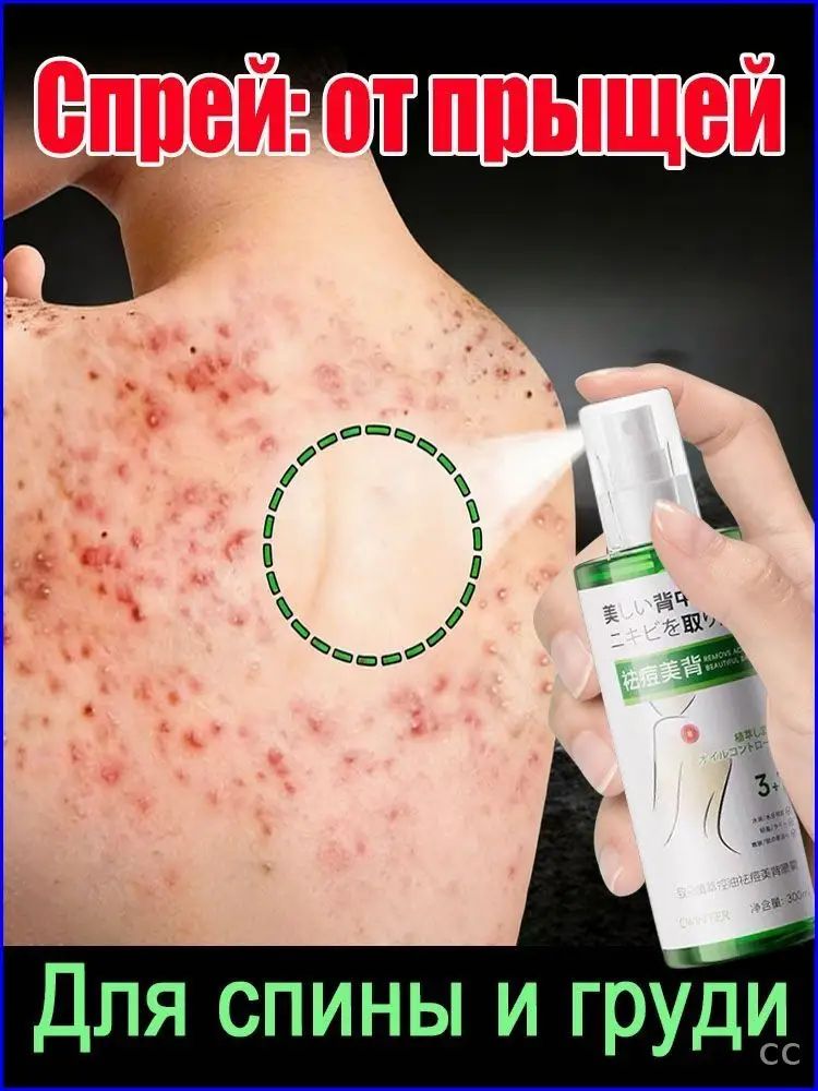 Спрей для ухода за кожей