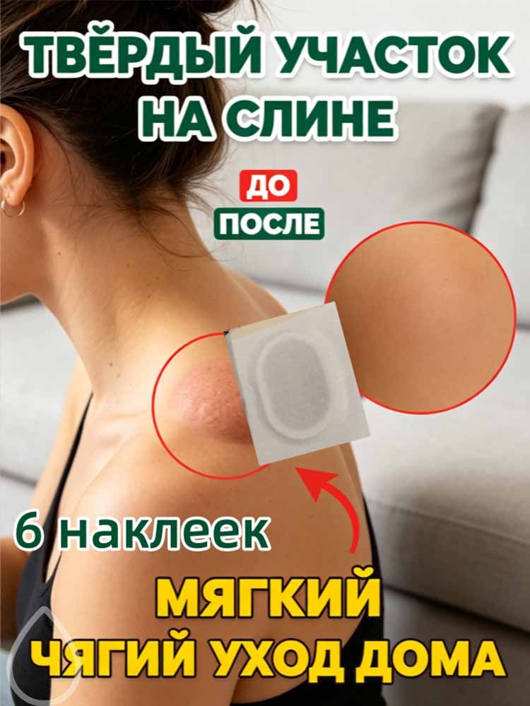 Пластырь для удаления липомы и жировиков 6 шт. Эффективное средство от прыщей и шишек в подмышках без операции