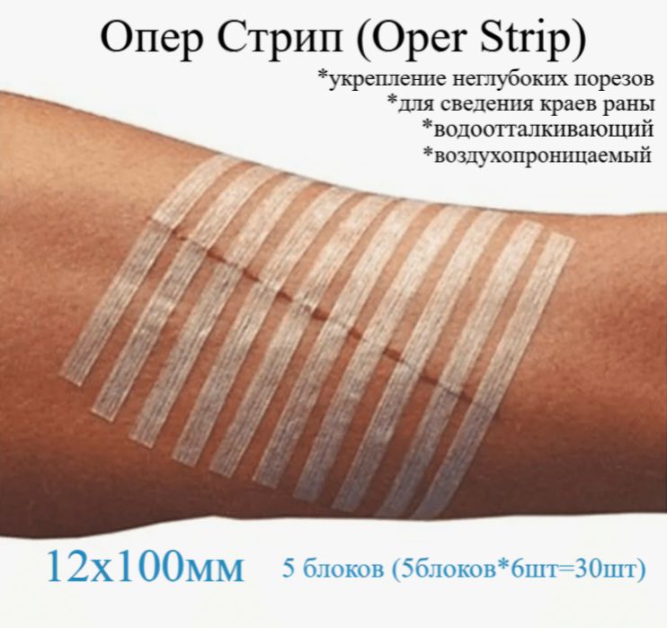 Полоски пластырные Опер Стрип (Oper Strip) гипоаллергенные стерильные размером 12 х 100мм, 0037804, 5 Блоков (5бл х 6шт30шт)