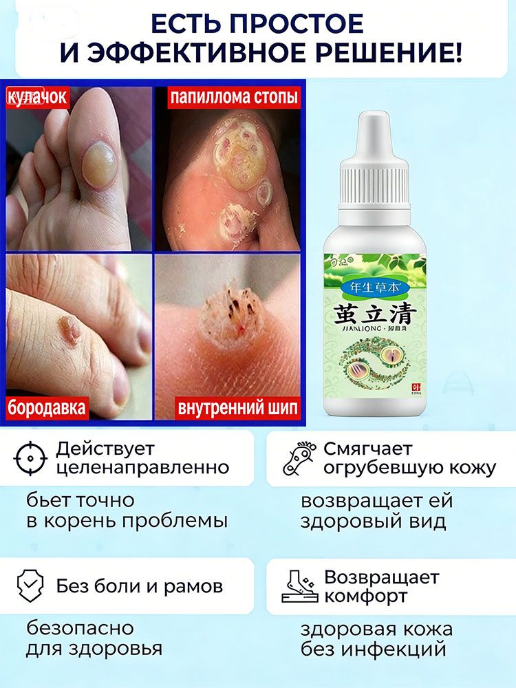 Специальное средство от подошвенных бородавок, от мозолей и подошвенных бородавок, 15 грамм
