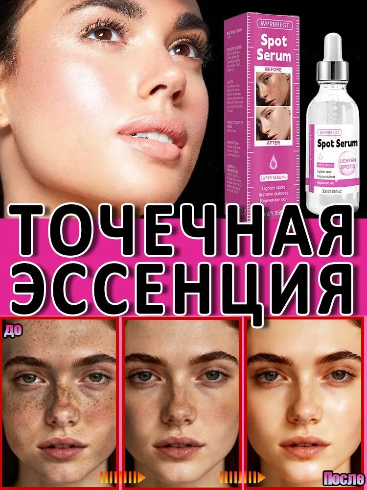 Эссенция для отбеливания лица и удаления пятен способна устранить веснушки, пигментные пятна и мелазму, осветлить пигментацию и улучшить тон кожи. Видимый результат через 7 дней. 300 мл