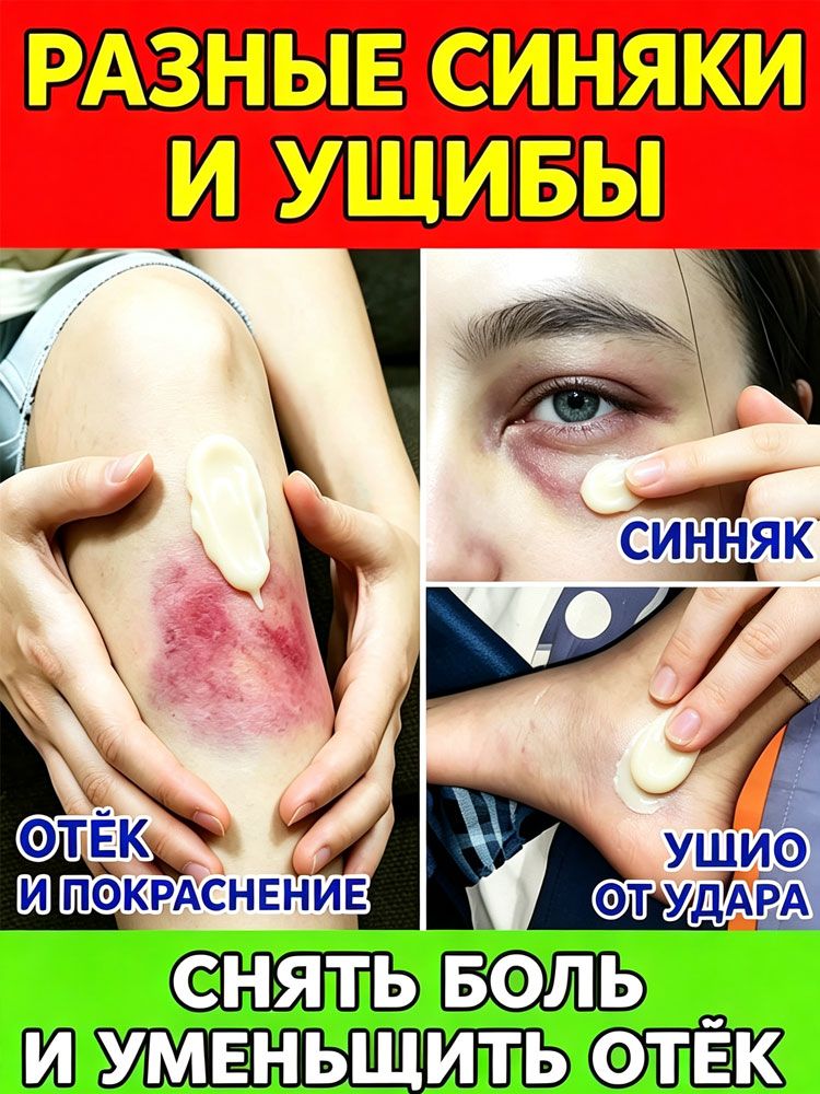 Гель крем для тела Заживитель с бодягой от синяков, ушибов, гематом, отеков рассасывающий 30 мл.