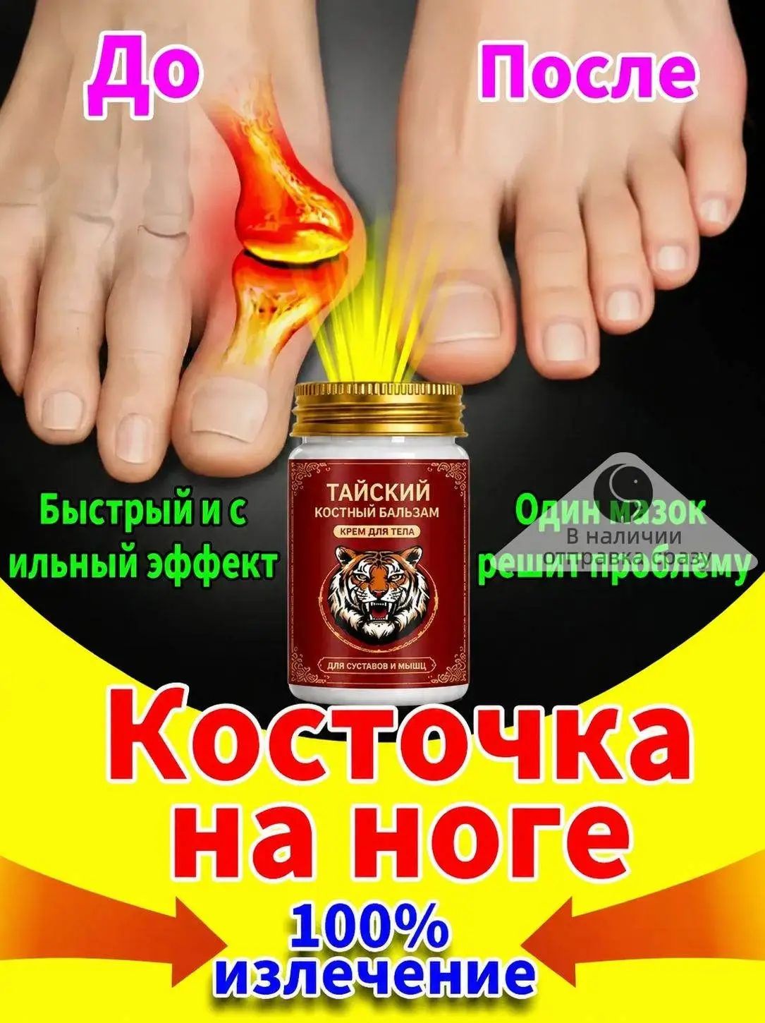 Мазь при вальгусной деформации косточки обезболивающая 50 г